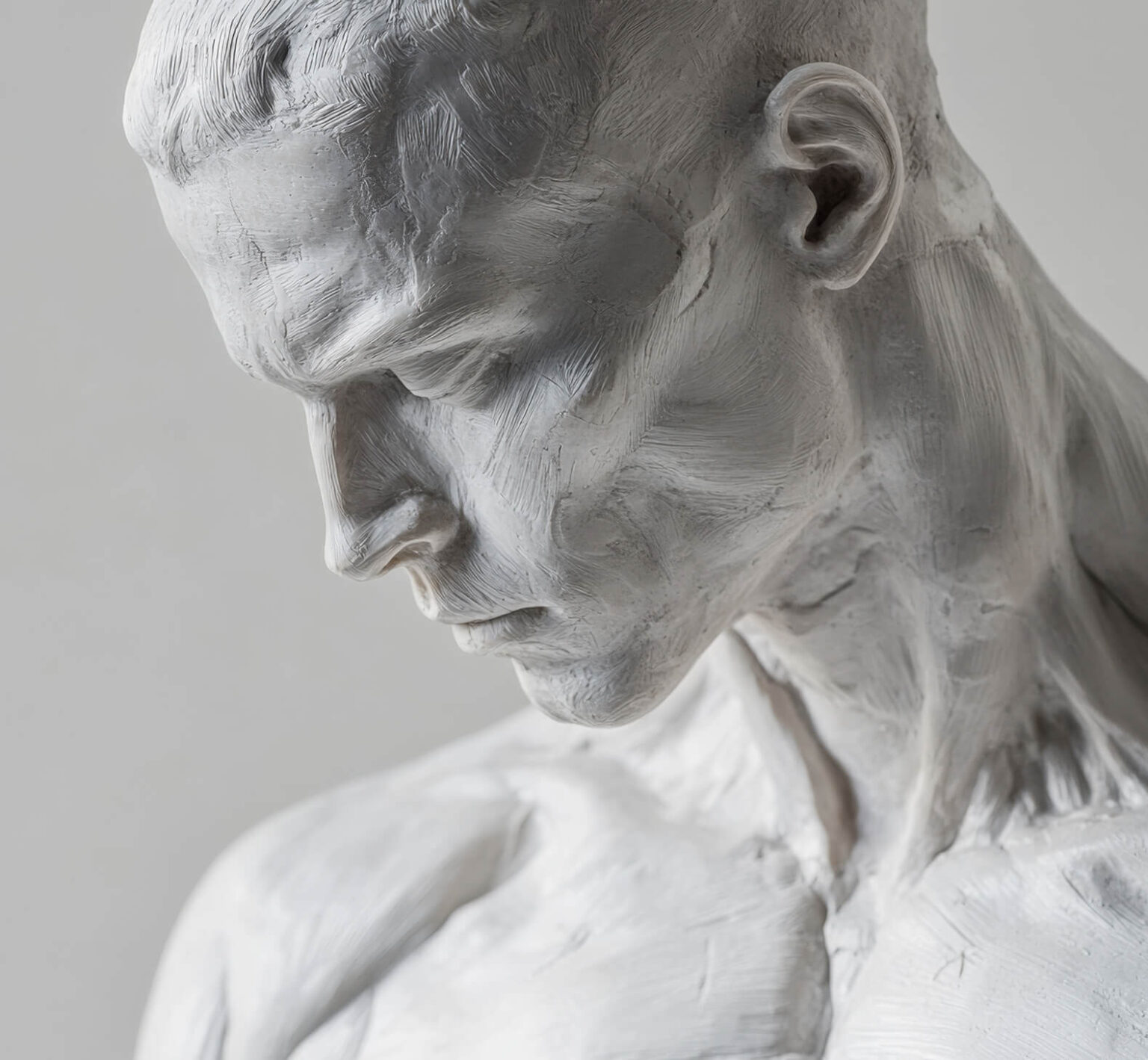 Osteotomia szczęki – Mooi Clinic